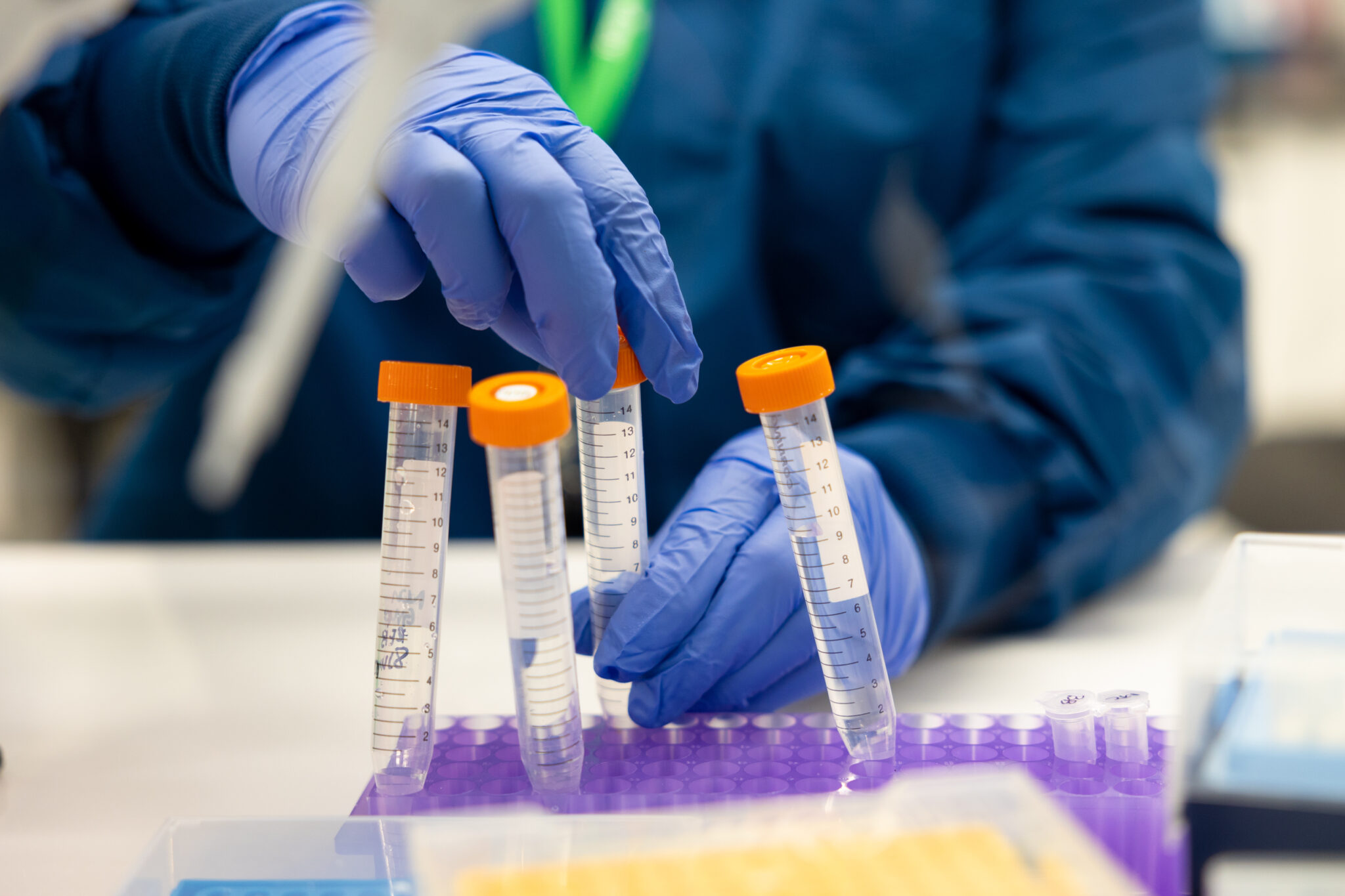 Opthalmology: Gene Therapy for Geographic Atrophy