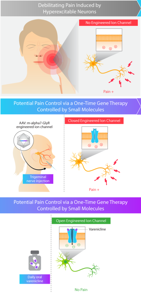Neurology: Gene Therapy for Trigeminal Neuralgia