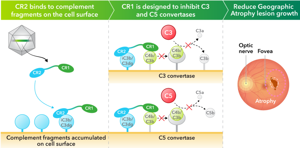Opthalmology: Gene Therapy for Geographic Atrophy
